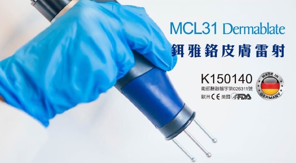 鉺雅鉻汽化雷射除痣(MCL31) – 江紀萱皮膚科附設醫美中心